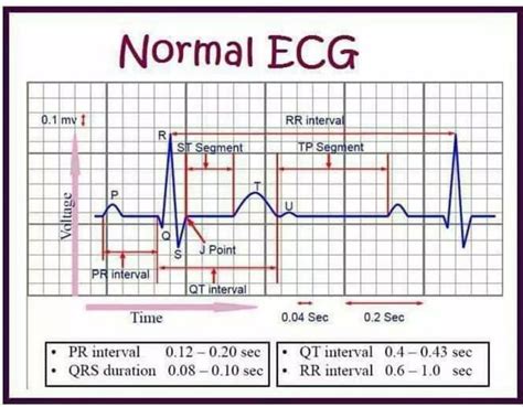 Normal Ecg Medizzy