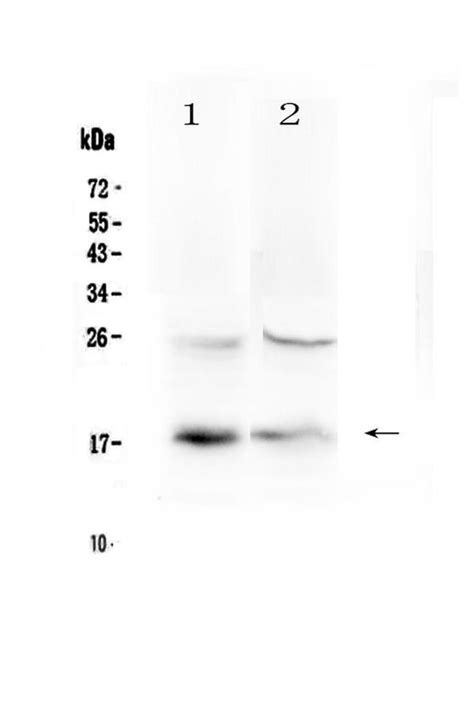 Tslp Polyclonal Antibody Pa5 80194