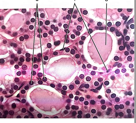 Thyroid Cell View Diagram Quizlet