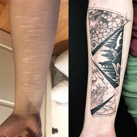 Arm Scar Cover Up Tattoo