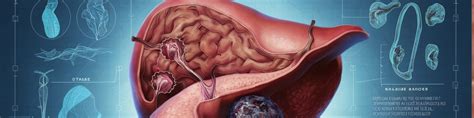 “gallbladder Cancer Types Causes Symptoms And Treatment”