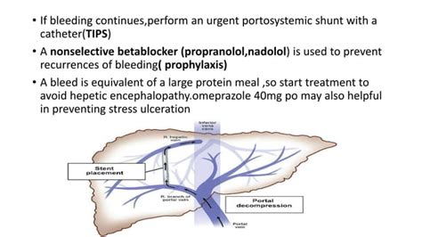 Upper Git Bleeding Pptx