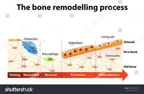 Bone Remodeling Process Involves Following Steps Stock Vector 333409151 Shutterstock