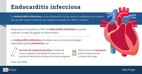 Endocarditis Infecciosa