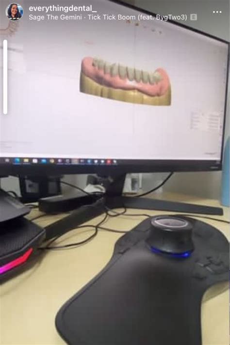 Donia Hazem On Linkedin Cadcamdentistry Digitaldentistry Dentures Dentistlife