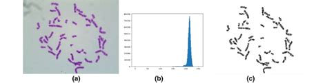 A Sample G Banded Microscopic Metaphase B Model Of Guassian Noise In