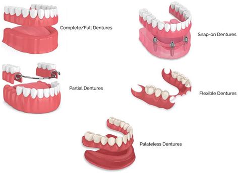 Machealers Dental Dentures In Türkiye
