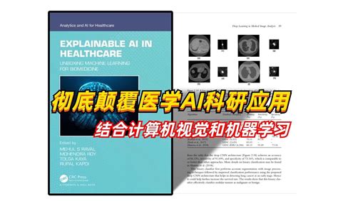 这本书直接封神！彻底颠覆医学ai科研应用的新书！ 哔哩哔哩