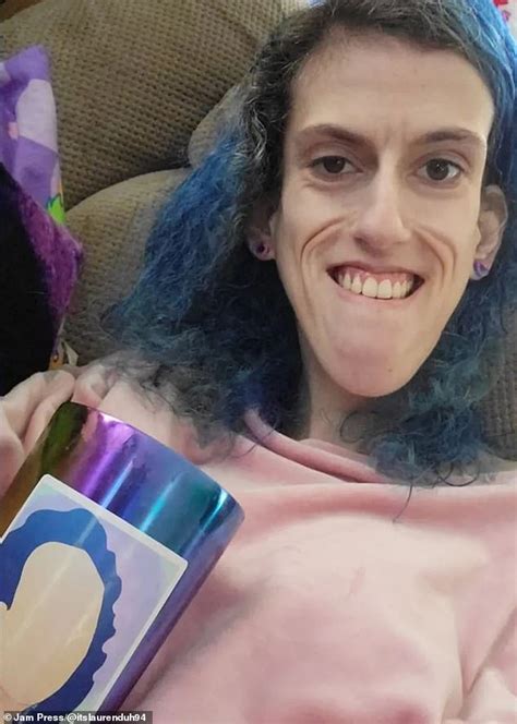 Woman With Facial Deformities Claps Back At Evil Trolls Big World Tale
