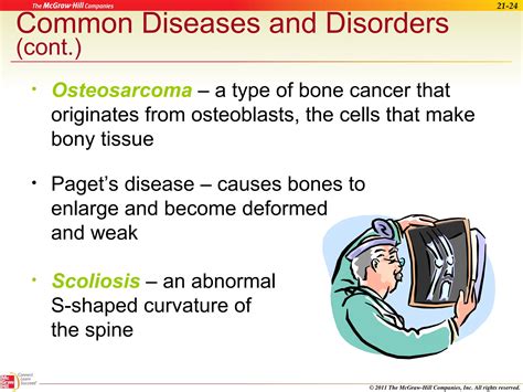 Skeletal System Ppt Skeletal System In Our Body Ppt