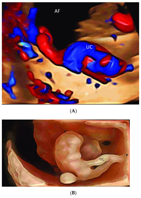 A Spatio Temporal Image Correlation Stic Volume Acquisition Download Scientific Diagram