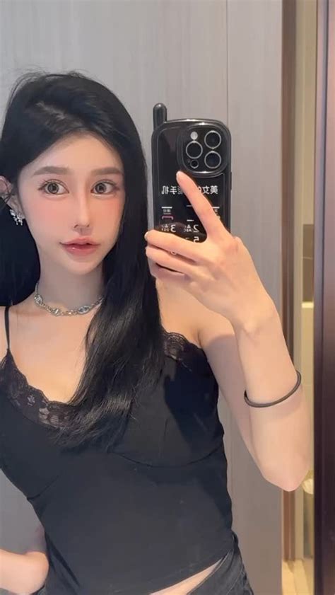 以前在台灣鼻子失敗五次 右邊就是一直縮的鼻子 以前真的好像小豬 在台灣做了三個醫生有一個還是鼻王 台灣的鼻子整形又貴的很嚇人要40w以上 而且