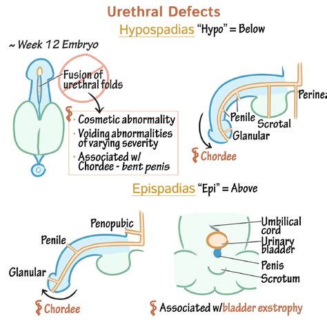 Epispadias Embryology Embryology Of The Urinary Tract Springerlink