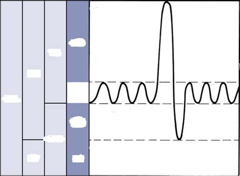 Spirogram Diagram Quizlet
