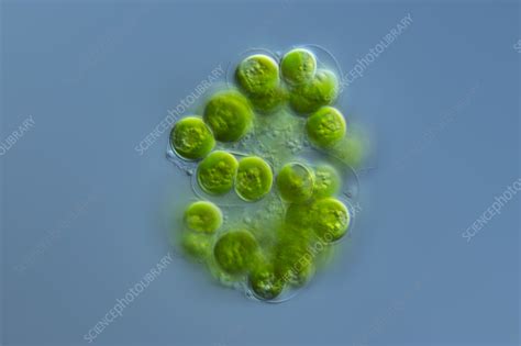Botryococcus Algae Light Micrograph Stock Image C058 6645 Science Photo Library