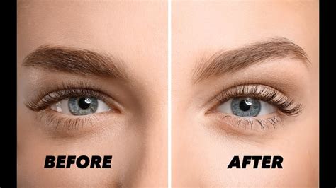 Easy Instant Eyelid Lift Without Surgery Eyelid Lift Hooded Eye My