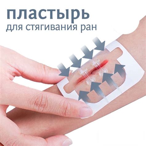 Лейкопластырь Пластырь для стягивания ран Пластырь для стяжки ран купить на Ozon по низкой