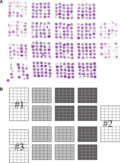 Organization Of Lung Tumor Tissue Microarray Tma A Hande Staining Of