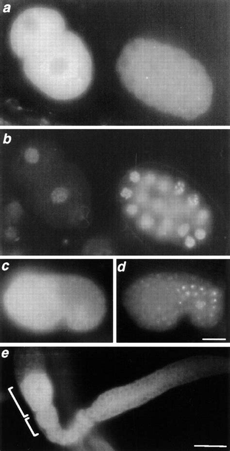 Localization Of Ncl 1 Protein A And B Immunofluorescence Micrographs Download Scientific