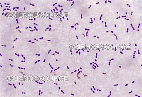 Streptococcus Group A Under A Microscope Streptococcus Group A Under A Microscope