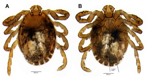 Dermacentor Variabilis Microscope
