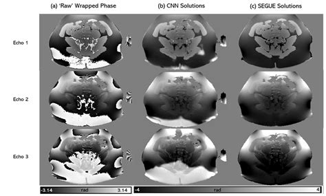 CNNgeneralization Study An Axial Slice Of A Representative Pelvic Image With Theraw Phase A