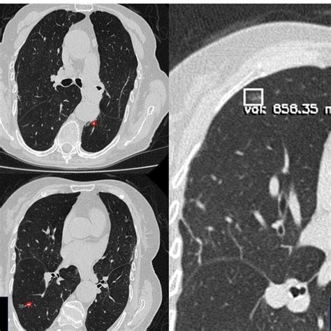 Case 3 From Dataset1 Case Without The Target Pathology Ai 2 Vessels Download Scientific