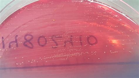 Enterococcus Gallinarum Introduction Morphology Pathogenicity