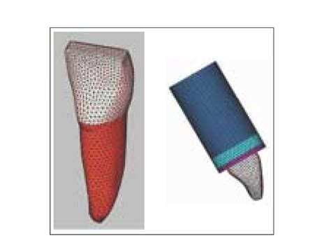 3 D Finite Element Model Of Maxillary Central Incisor Download Scientific Diagram