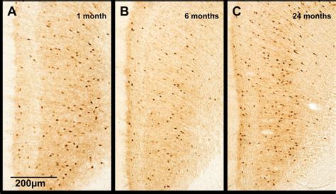 Pv Expression Within The Retrosplenial Cortex Across Age Groups
