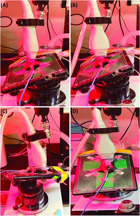 A Representative Image Showing Probe Positioning To Obtain Download Scientific Diagram