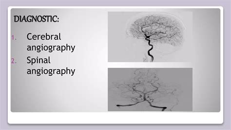 Neuro Interventional Procedures Pptx