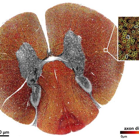 Large Scale Segmentation Axon Display In A Cat Spinal Cord Cervical Download Scientific