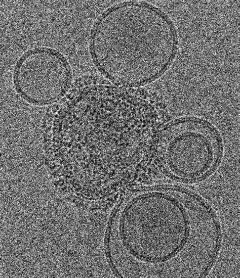 Flu Virus Electron Microscope