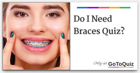 Do I Need Braces Quiz