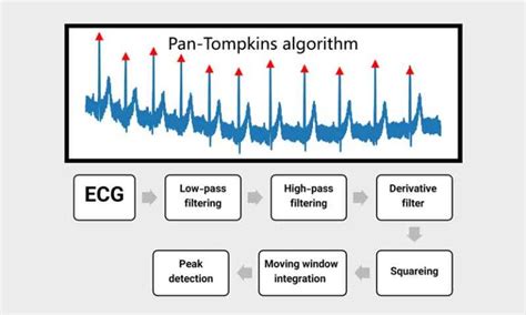 الگوریتم Pan Tompkins در تشخیص پیکهای R سیگنال Ecg آکادمی آنلاین مهندسی پزشکی و هوش مصنوعی