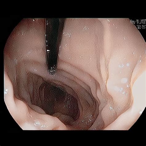 Medisyn Text Guided Diffusion Models For Broad Medical 2d And 3d Image