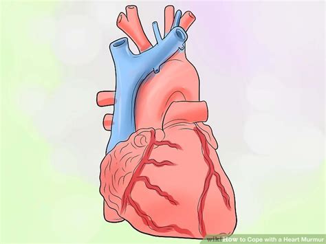5 Ways To Cope With A Heart Murmur Wikihow Health