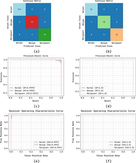 Classifier Outcome On Mias Mammography Dataset Training Of A