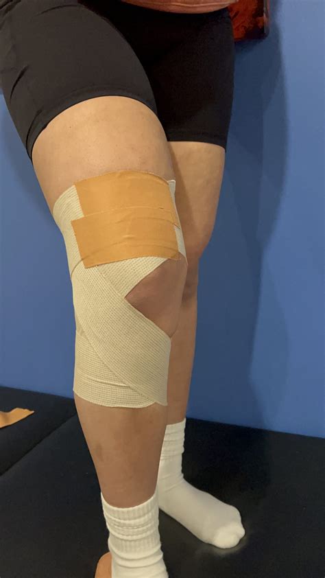 Knee Lcl Taping Strapup