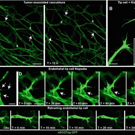 Investigating Migrating Endothelial Cells A Subsequential Maximal Download Scientific