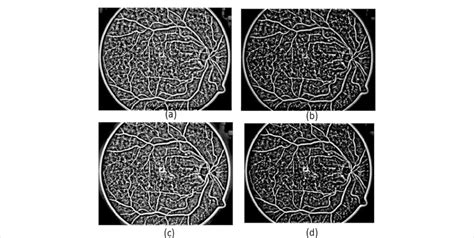 Adaptive Histogram Equalisation Results A R 3 H 45 B R 6 Download Scientific