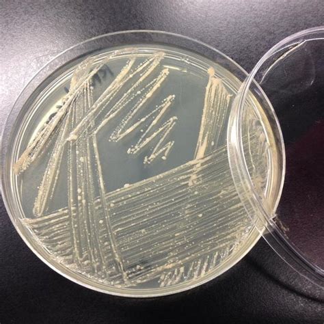 Gram Staining Of Mucoid Rhodococcus Equi Colonies Amplification Download Scientific Diagram