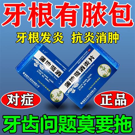 牙龈肿痛消炎药治疗牙根鼓包流脓牙髓炎智齿发炎止痛蒲地蓝消炎片