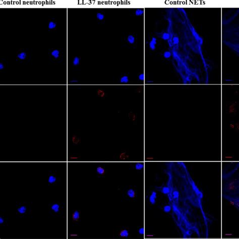 Immune Detection Of Human Myeloperoxidase In Neutrophils And Nets Download Scientific Diagram