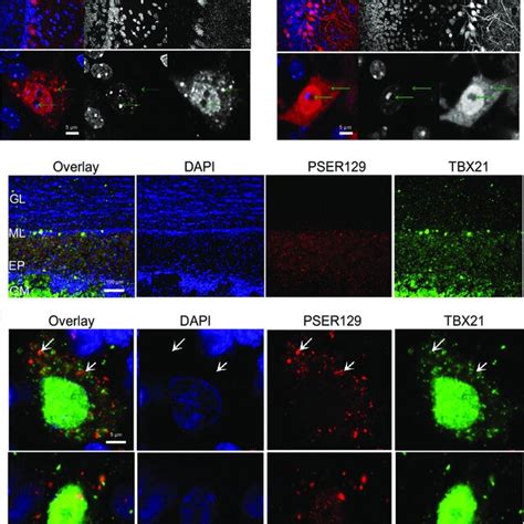 Pdf Distribution Of Phosphorylated Alpha Synuclein In Non Diseased Brain Implicates Olfactory