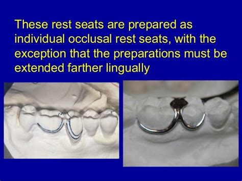 Rest And Rest Seat