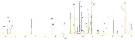 1 H Nmr Cpmg Median Spectra Of Each Group Metabolite Names Listed In Download Scientific