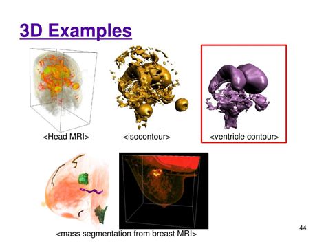 Ppt Lecture 4 Isosurface Extraction Powerpoint Presentation Free
