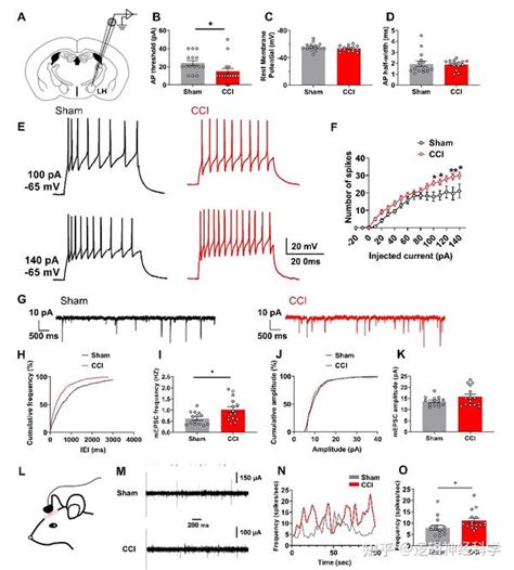 Neurobiol Dis︱郑州大学杨建军课题组揭示外侧下丘脑 外侧缰核神经环路在神经病理性疼痛中的重要作用 知乎